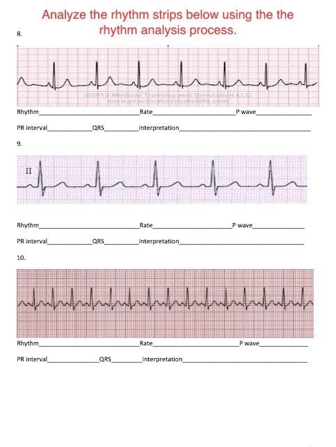 Solved Analyze the rhythm strips below using the the rhythm | Chegg.com