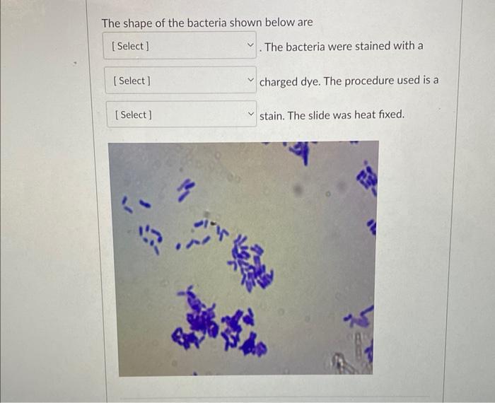 Solved options 1:cocci, bacilli,spiral2: positive, negative | Chegg.com