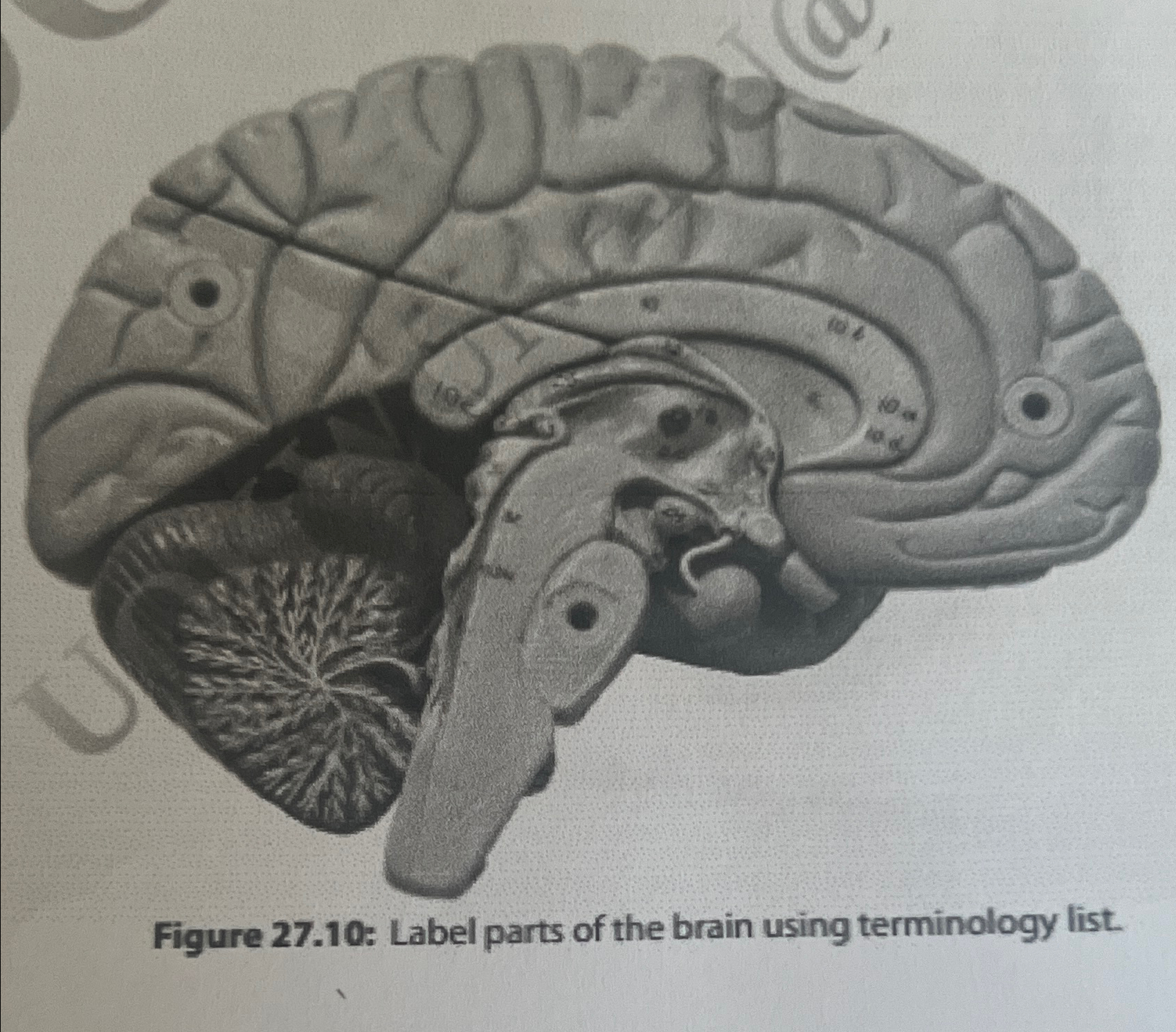 Solved Label parts of the brain using terminology | Chegg.com