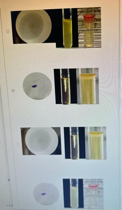 Solved a variant of Escherichia coli is isolated from a | Chegg.com