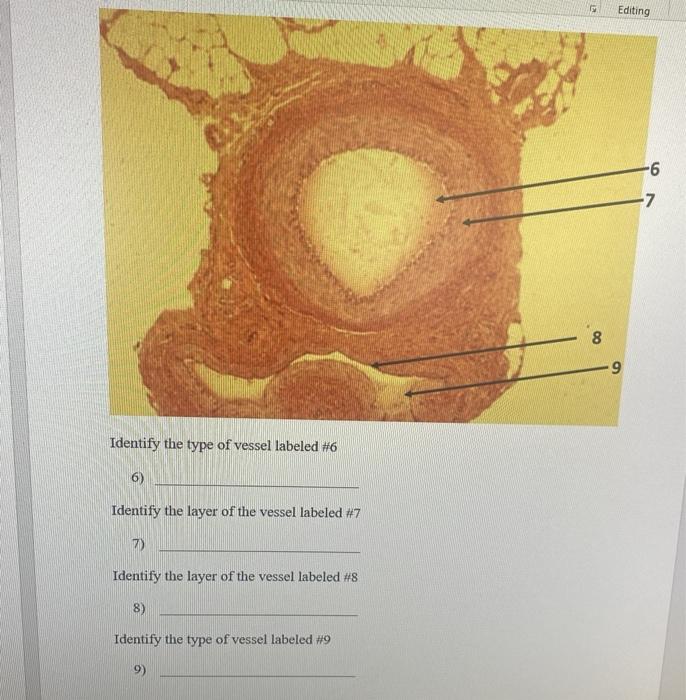 Solved Editing -6 -7 00 9 Identify the type of vessel | Chegg.com