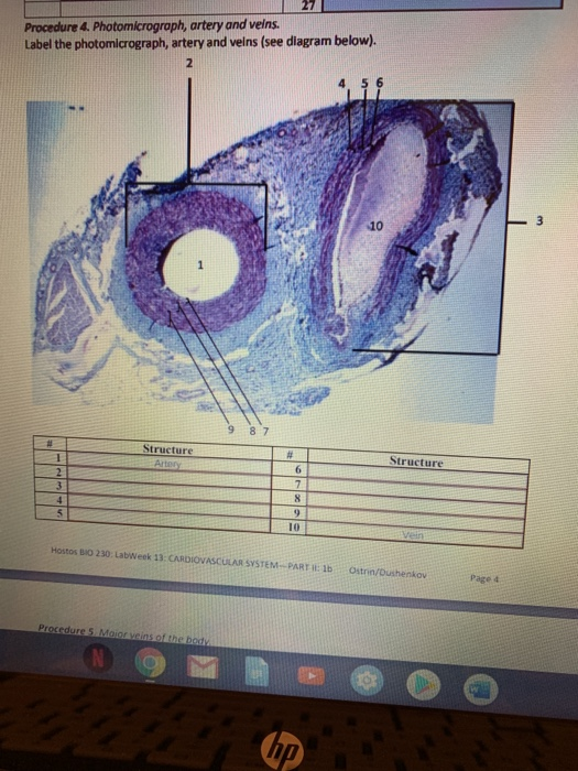 Solved Procedure 4. Photomicrograph, artery and veins. Label | Chegg.com