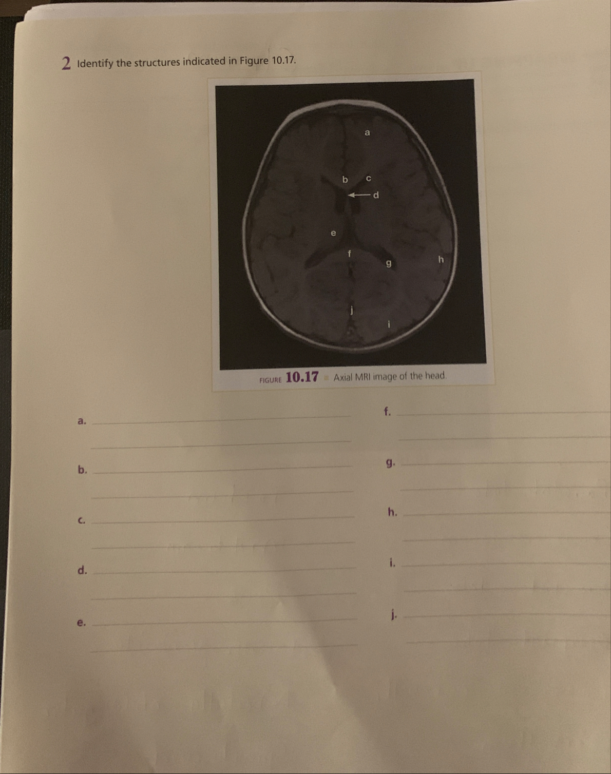 2 ﻿Identify the structures indicated in Figure | Chegg.com