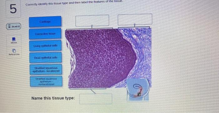 Solved Correctly identify this tissue type and then label | Chegg.com