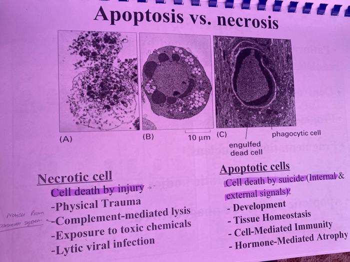 Apoptosis vs. necrosis (A) (B) 10 um Necrotic cell | Chegg.com