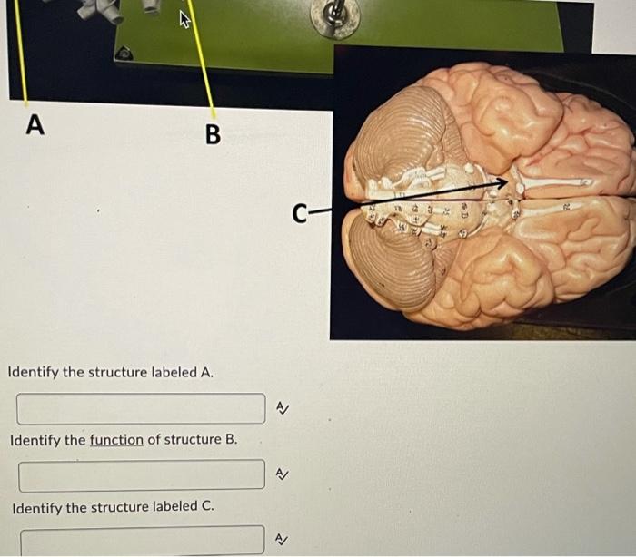 Solved А В C Identify the structure labeled A. A/ What type | Chegg.com