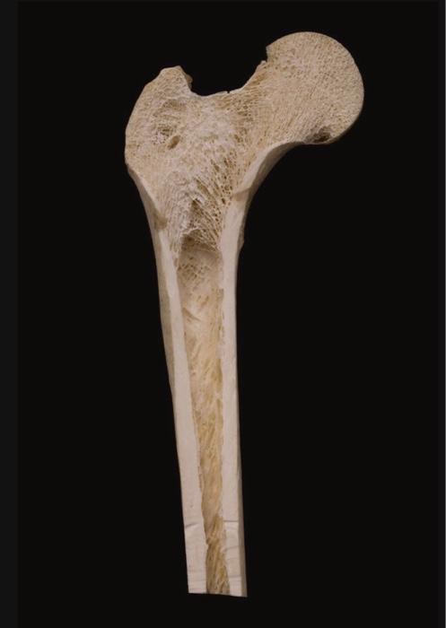 Solved Examine the cut section of the long bone diagram. | Chegg.com