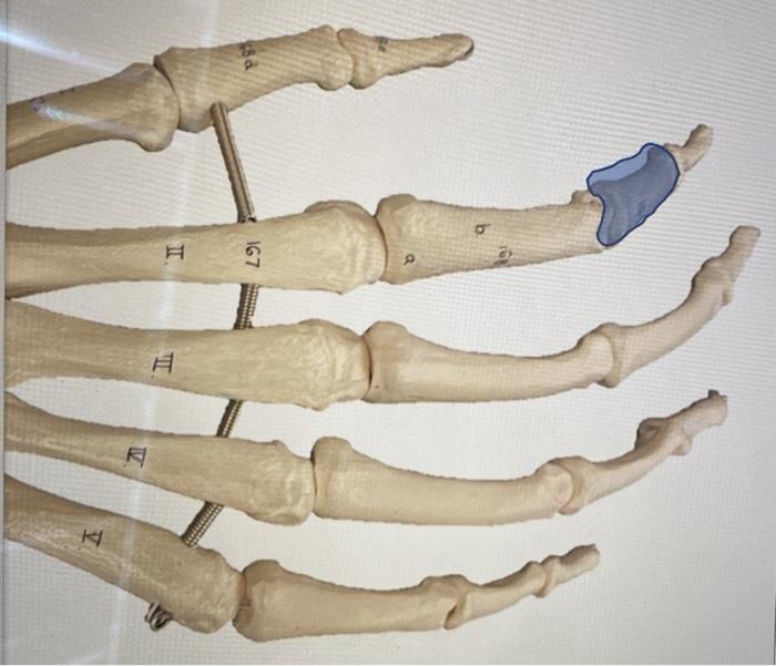 Solved Lunate Capitate Scaphoid Trapezoid Trapezium | Chegg.com