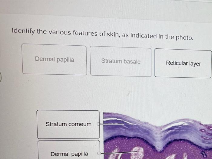 Identify the various features of skin, as indicated | Chegg.com