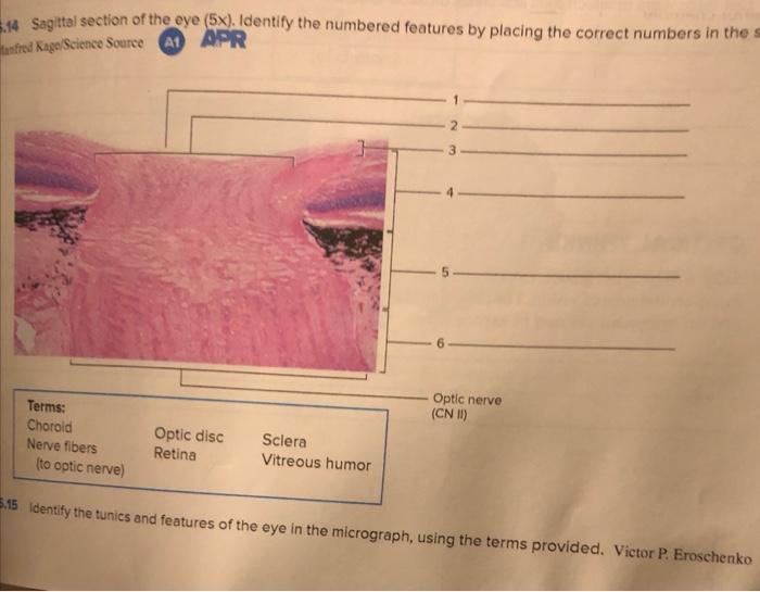 Solved 14 Sagittal section of the eye (5x). Identify the | Chegg.com