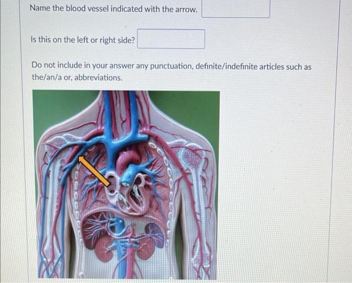 Solved Name the blood vessel indicated with the arrow. Is | Chegg.com