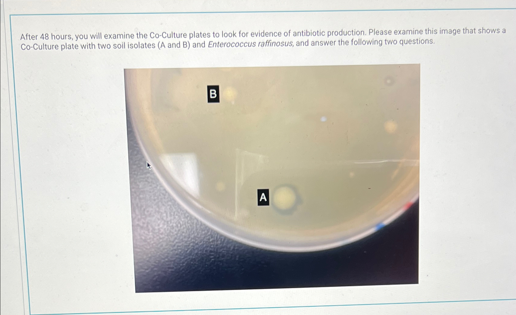 Solved After 48 ﻿hours, you will examine the Co-Culture | Chegg.com