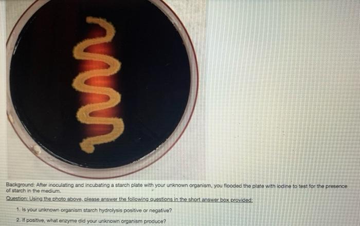 Solved Background After inoculating and incubating a starch | Chegg.com