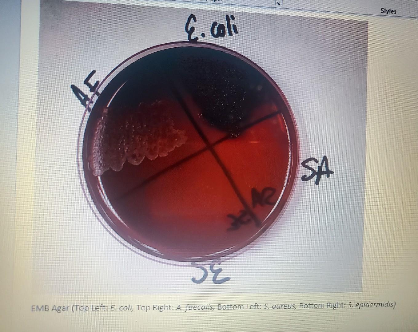 Solved RESULTS Nutrient Agar Mannitol Salt Agar Organism EMB | Chegg.com