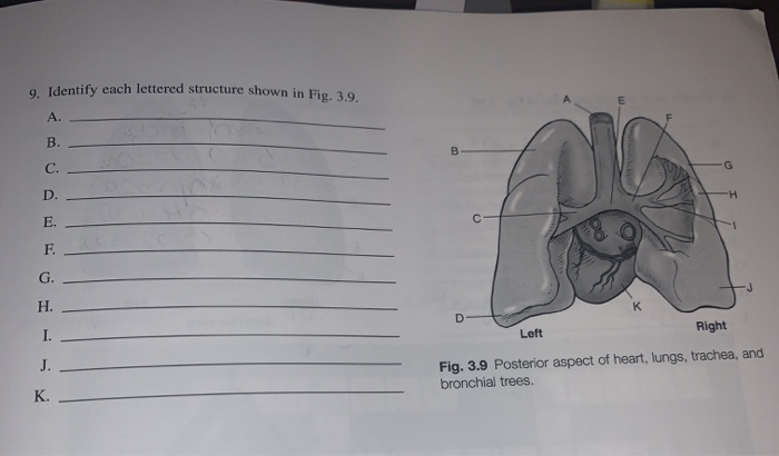 Solved E H 8. Identify each lettered structure shown in Fig. | Chegg.com