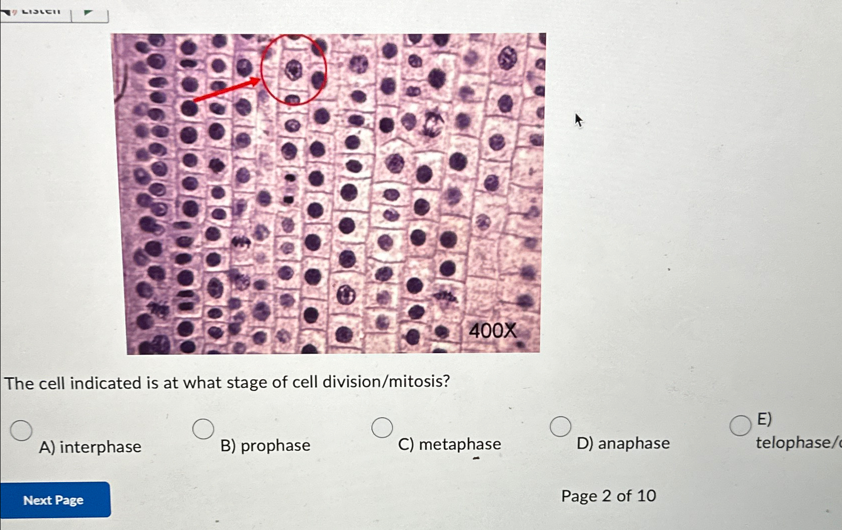 Solved The cell indicated is at what stage of cell | Chegg.com