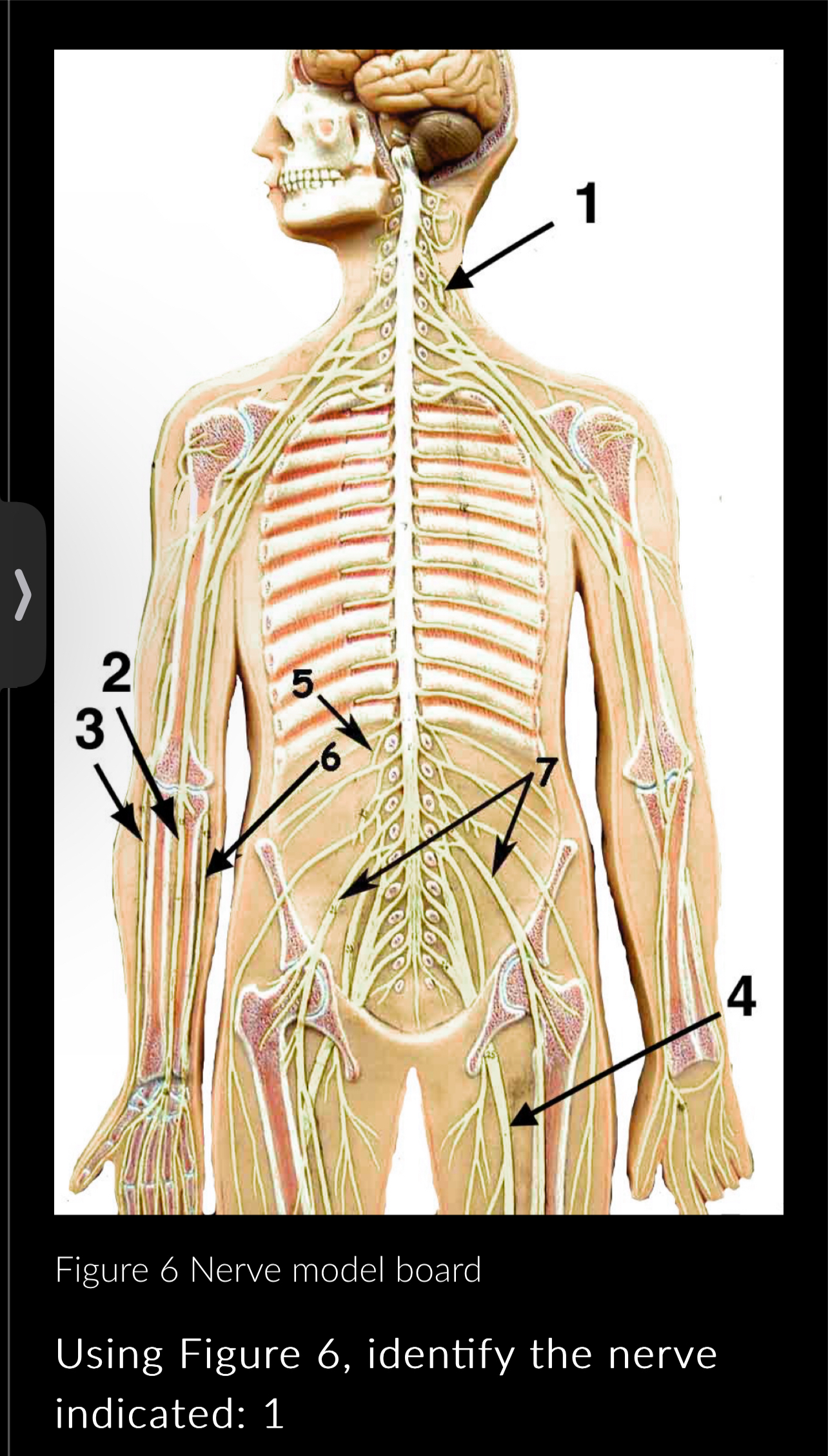 Solved Figure 6 Nerve model boardUsing Figure 6, identify | Chegg.com Solved Figure 6 Nerve model boardUsing Figure 6, identify | Chegg.com