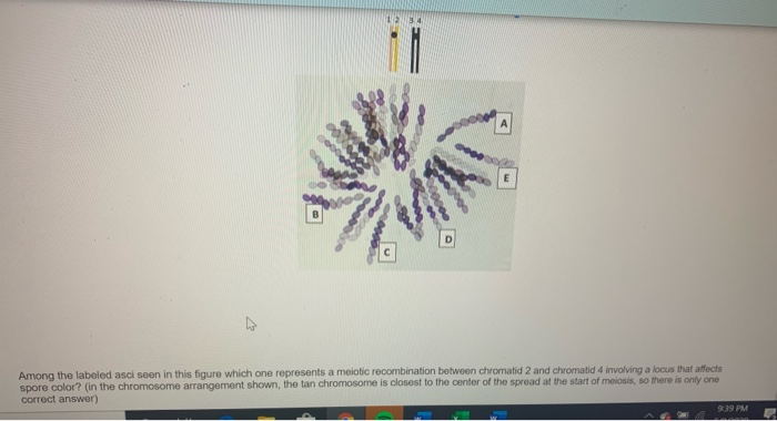 Solved Among the labeled asci seen in this figure which one | Chegg.com