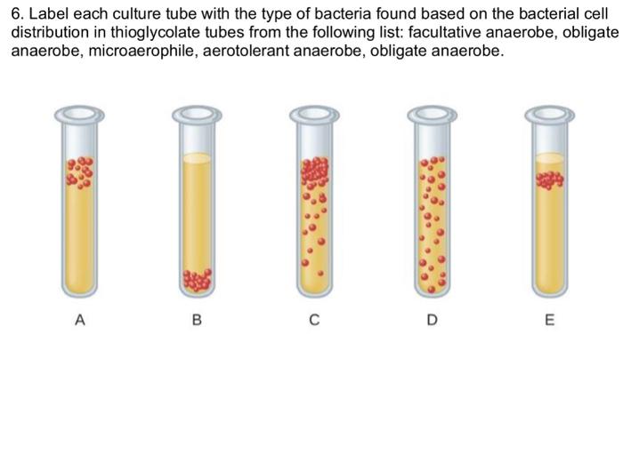 Solved Label each culture tube with the type of bacteria | Chegg.com