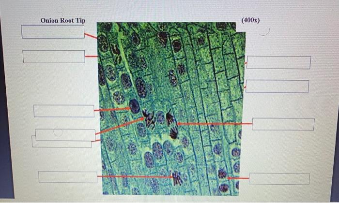 Solved Onion Cell Pictures The next two images are real | Chegg.com