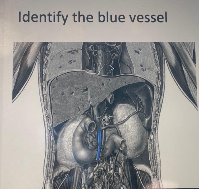 Solved Identify the blue vessel | Chegg.com