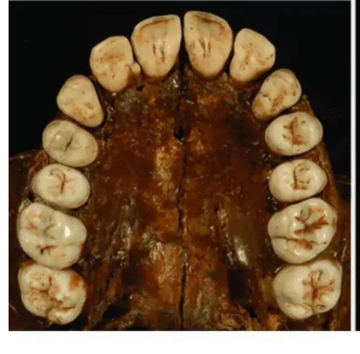 Solved The image below shows a set of remains recovered from | Chegg.com