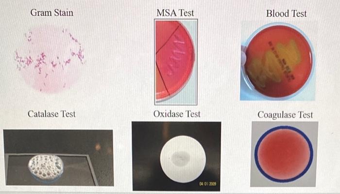 Solved Gram Stain MSA Test Blood Test Catalase Test Oxidase | Chegg.com