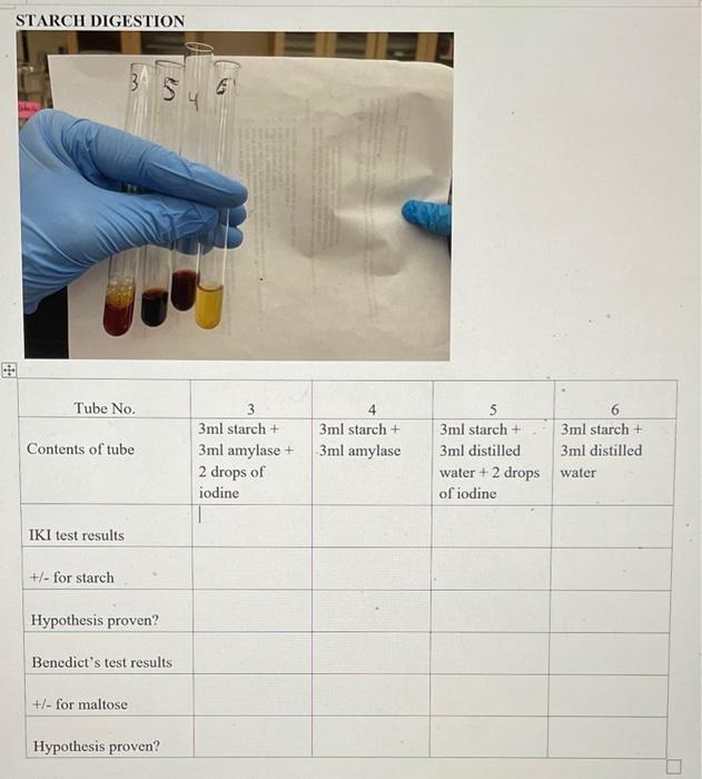 Solved Starch Digestion test, the picture is my result from | Chegg.com