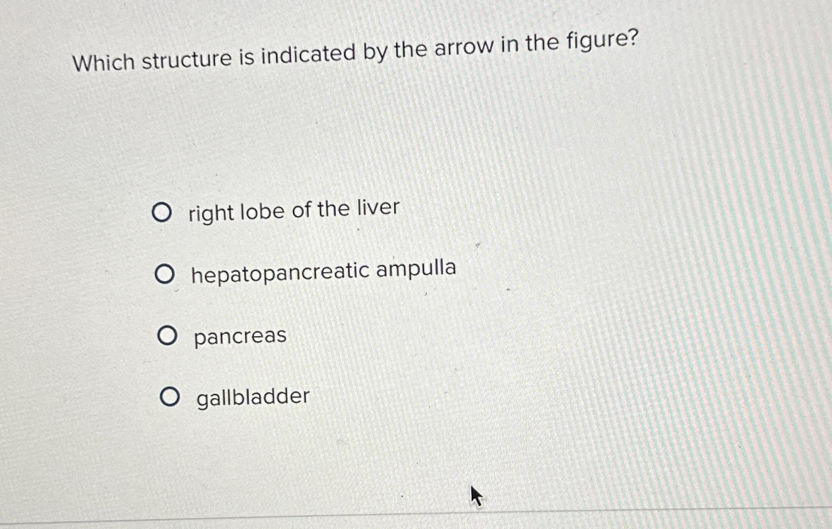 Which structure is indicated by the arrow in the | Chegg.com