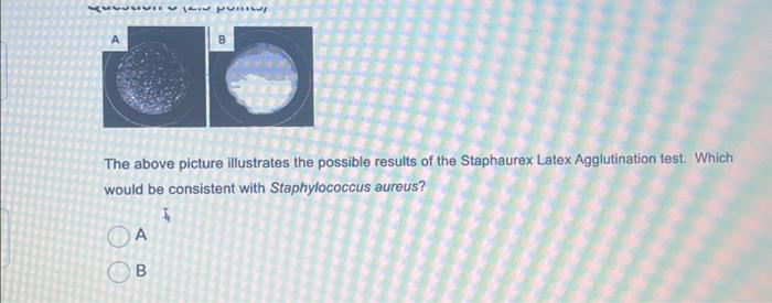 Solved The above picture illustrates the possible results of | Chegg.com