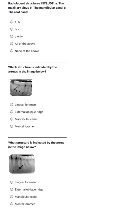 Solved Radiolucent structures INCLUDE: a. The maxillary | Chegg.com