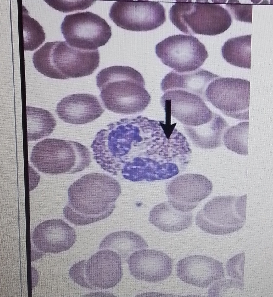 Solved Describe picture | Chegg.com Solved Describe picture | Chegg.com