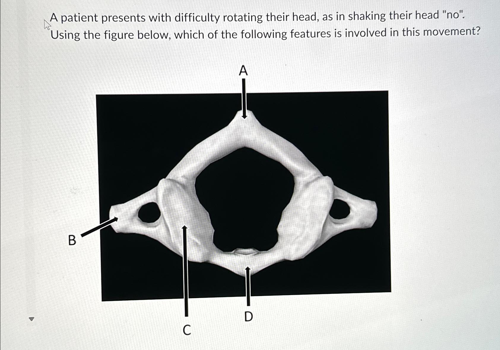Solved A patient presents with difficulty rotating their | Chegg.com