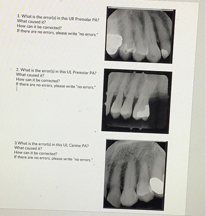 Solved 1. What is the error(s) in this UR Premolar PA? What | Chegg.com