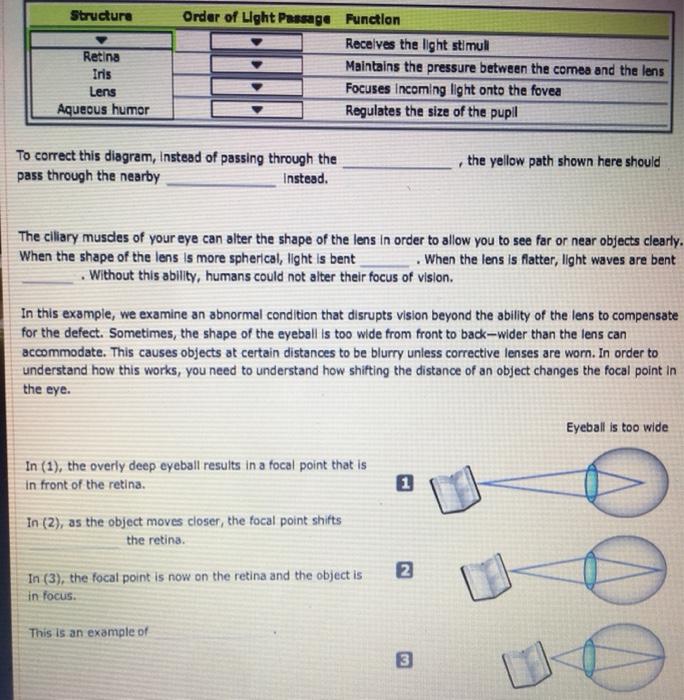 Solved Structura Retina Iris Lens Aqueous humor Order of | Chegg.com