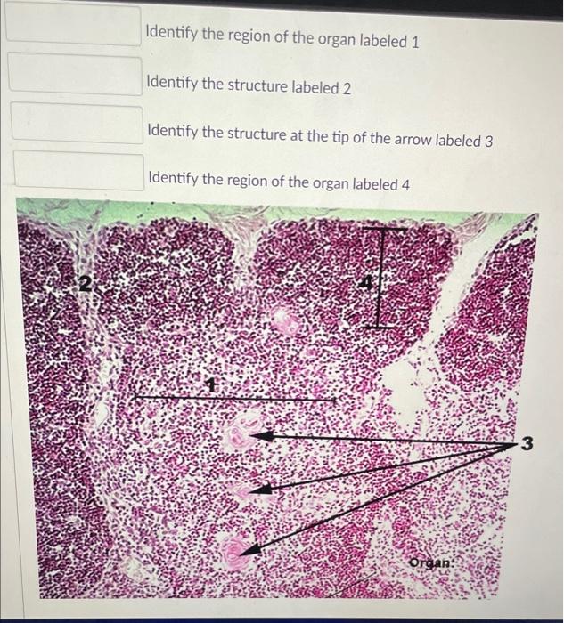Identify the organ. Identify the region of the organ | Chegg.com