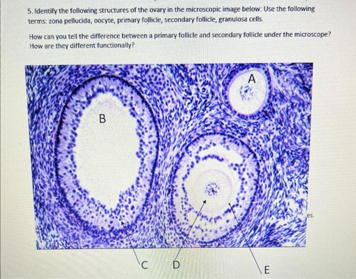 Solved 5. Identify the following structures of the ovary in | Chegg.com
