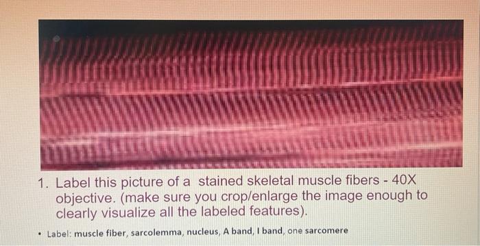 Solved 1. Label this picture of a stained skeletal muscle | Chegg.com