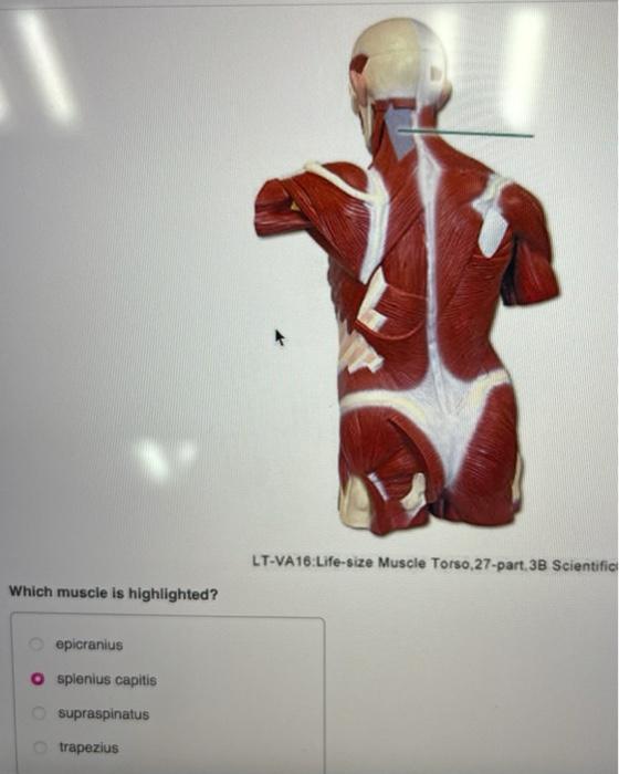 Solved LT-VA16:Life-size Muscle Torso.27-part 3B Scientific | Chegg.com