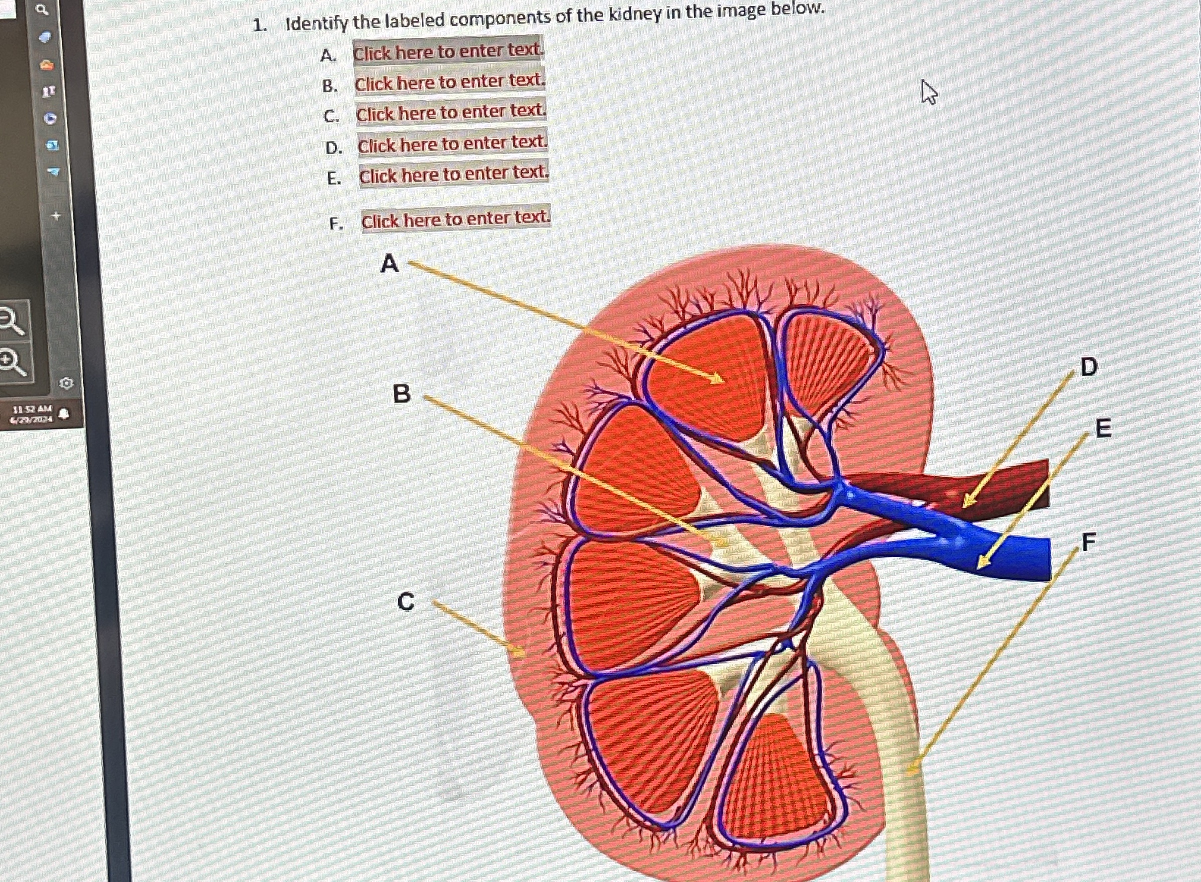 Solved Identify the labeled components of the kidney in the | Chegg.com