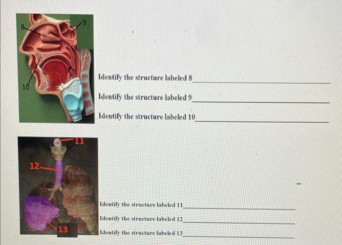 Solved 9 Identify the structure labeled 8 10 Identify the | Chegg.com