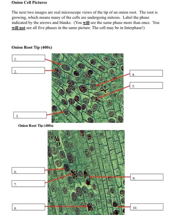 Solved Onion Cell Pictures The next two images are real | Chegg.com