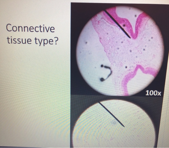 Solved Connective tissue type? 100x | Chegg.com