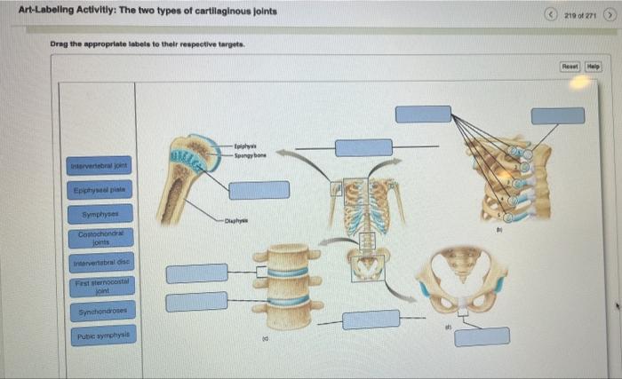 Solved Art-Labeling Activitly: The two types of | Chegg.com
