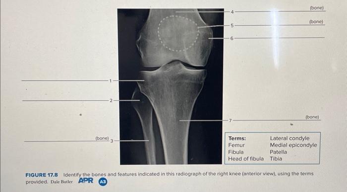 Solved FIGURE 17.8 Identify the bones and features indicated | Chegg.com