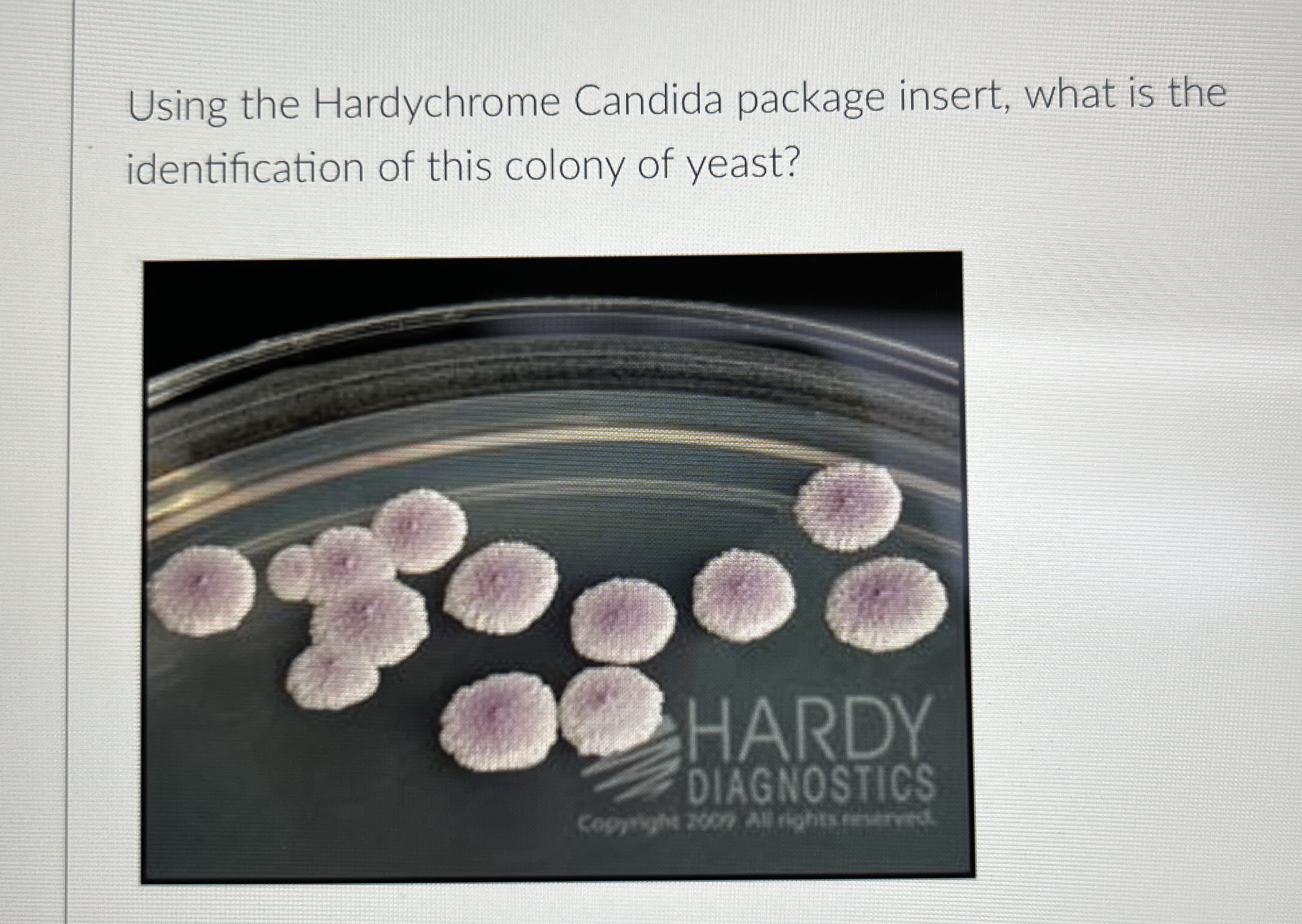 Solved Using the Hardychrome Candida package insert, what is | Chegg.com