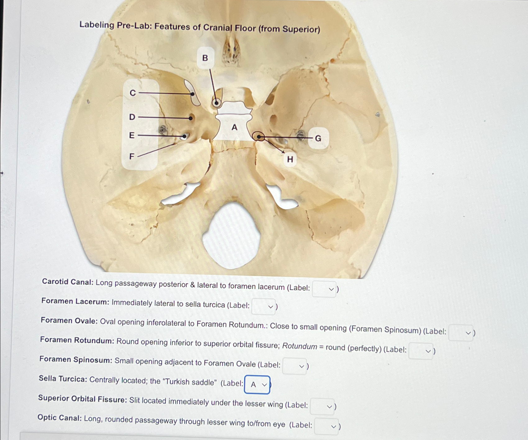 Solved Labeling Pre-Lab: Features of Cranial Floor (from | Chegg.com