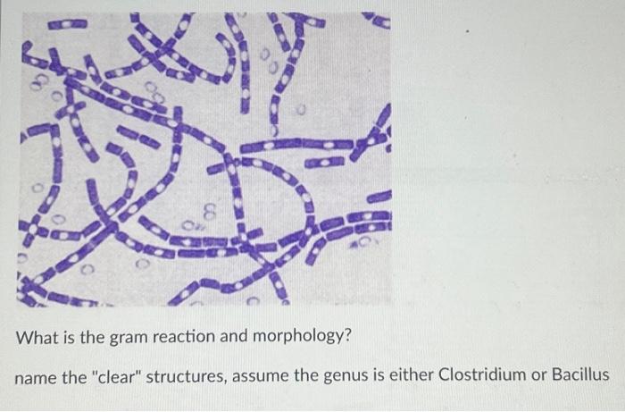 Solved What is the gram reaction and morphology? name the | Chegg.com