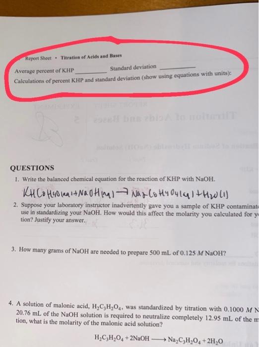 Solved REPORT SHEET Titration of Acids and Bases EXPERIMENT | Chegg.com