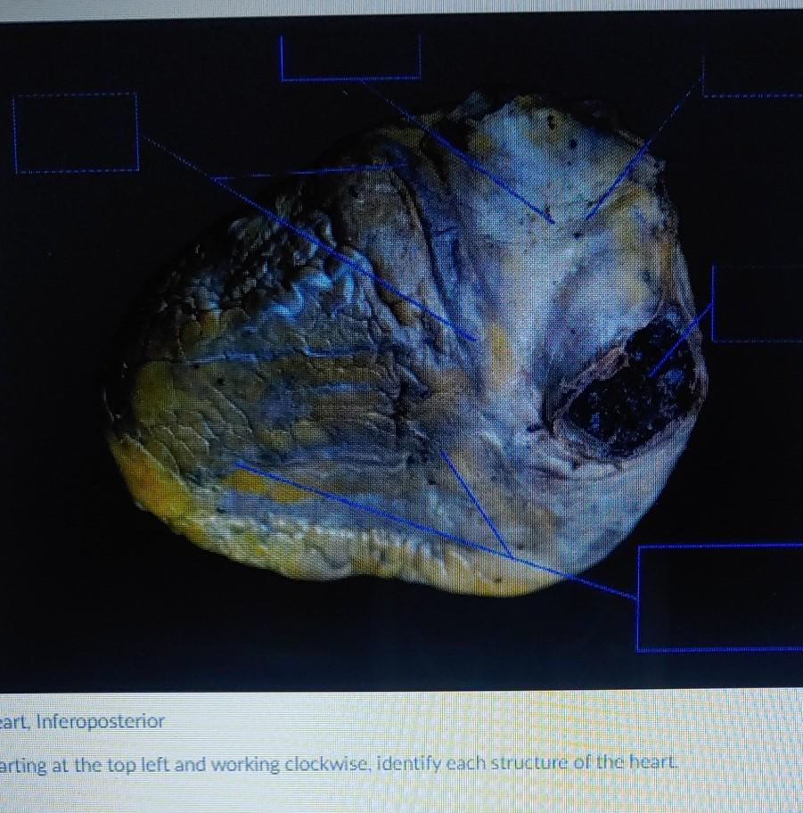 Solved eart, Inferoposterior arting at the top left and | Chegg.com